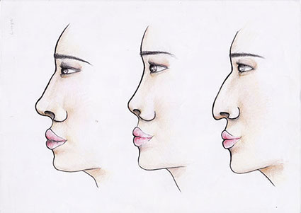 Nose, Beauty, and Physiognomy